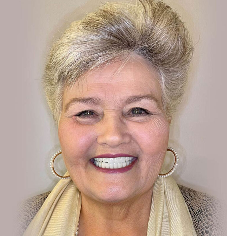 Before & After Photos | Union Dental Implant Center | Austin, TX