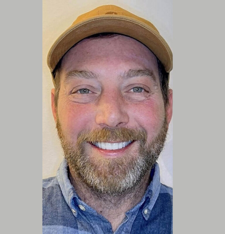 Before & After Photos | Union Dental Implant Center | Austin, TX