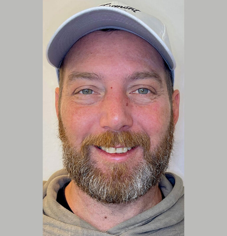 Before & After Photos | Union Dental Implant Center | Austin, TX